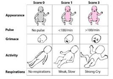 APGAR score (아프가 점수) : 네이버 블로그